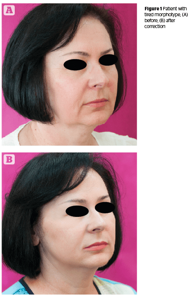 Aging Morphotypes classification and treatments | PRIME Journal