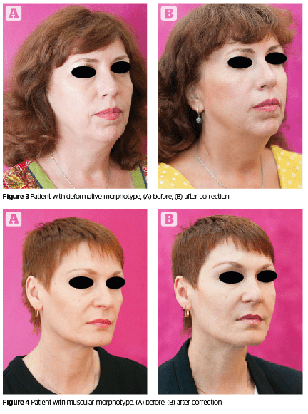 Aging Morphotypes classification and treatments | PRIME Journal