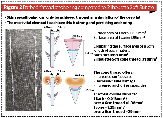 Cone sutures less invasive, more efficient | PRIME Journal